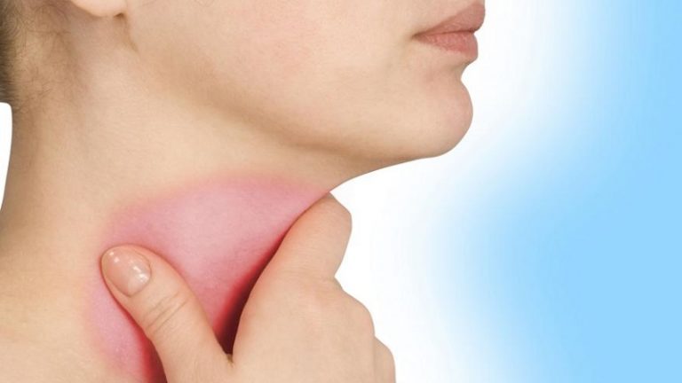 Faringitis: causas, síntomas y tratamiento - EuropaDigital